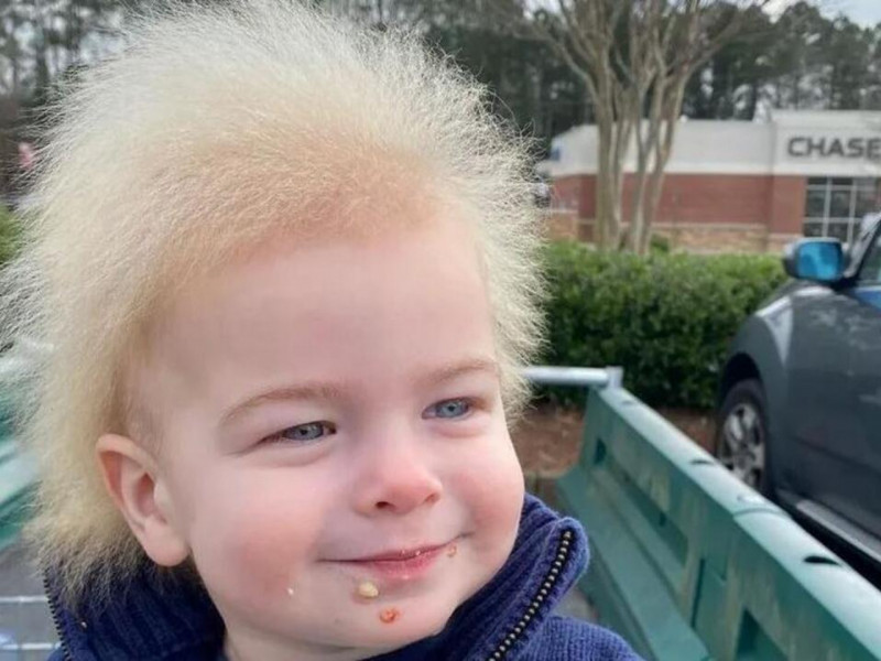 Conheça Locklan: o menino do cabelo impenteável - Angola