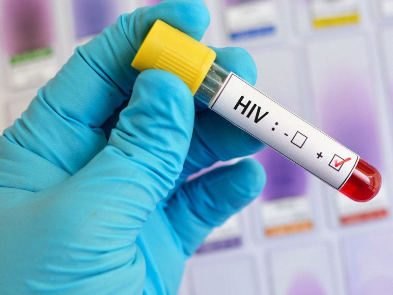 SIDA com números preocupantes e Governo aponta redução de infecções ...